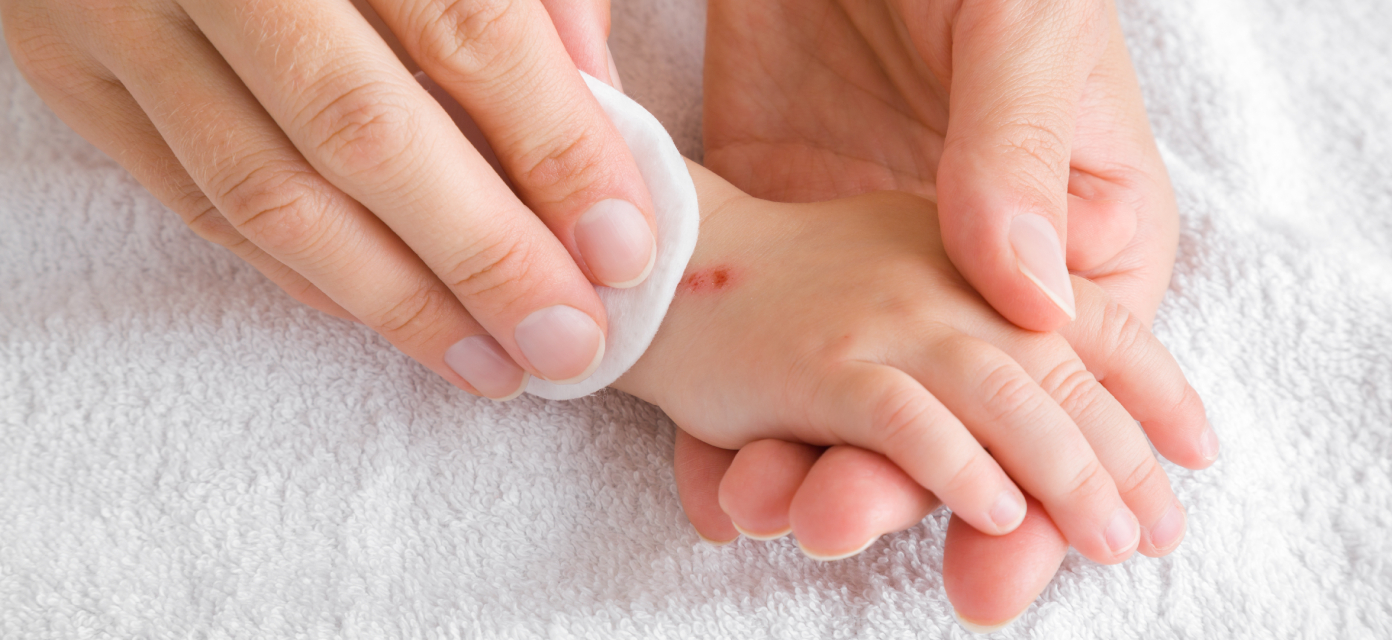 Disinfezione della ferita: prodotti e consigli - Più Medical